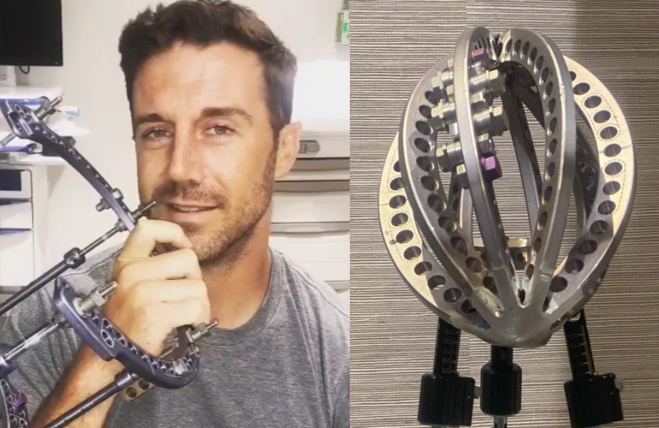 Alex Smith's Leg Brace Is Now A Lombardi Trophy Art Piece | OutKick