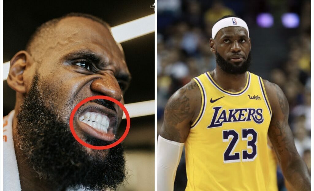Lebron James Teeth LeBron James LeBron James Added A New Photo.