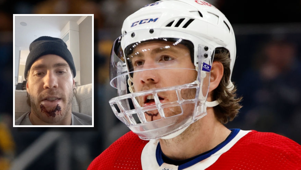 Mike Hoffman Wants To Know Why Cross-Check To His Face Is Only A One ...