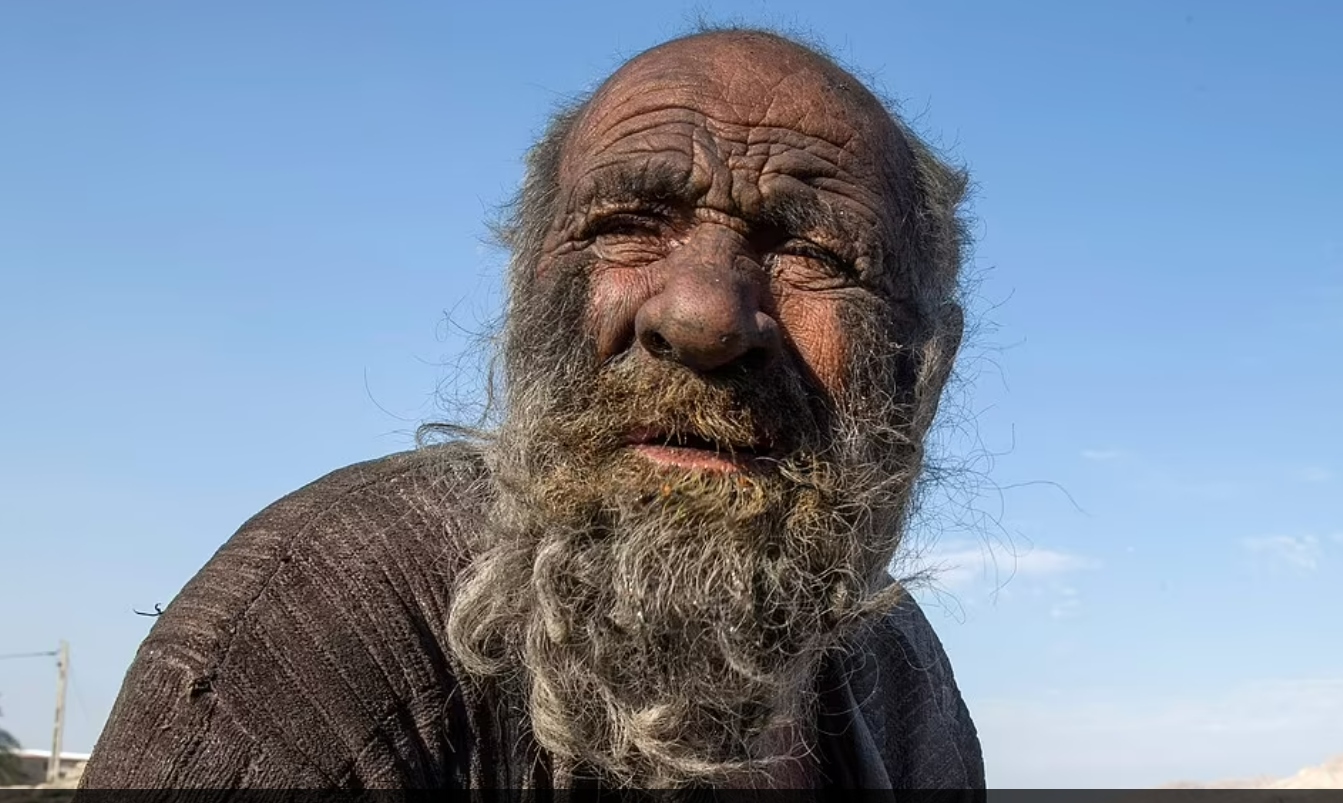 World's Dirtiest Person Has Died At 94, Hadn't Showered In 60 Years ...