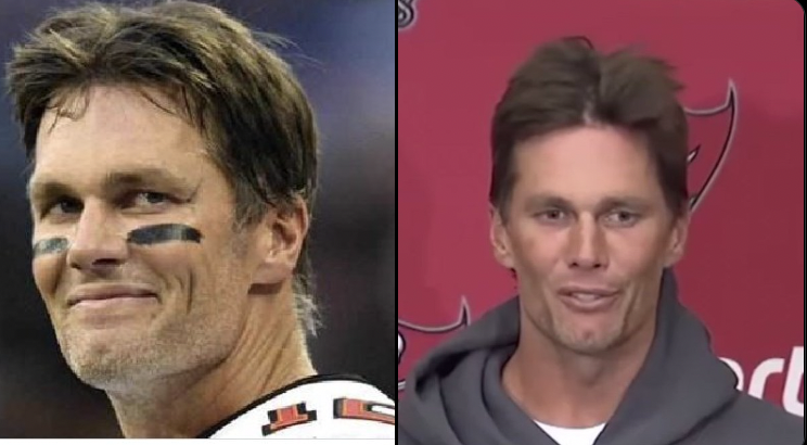 Tom Brady Appears to Have a New Face | OutKick