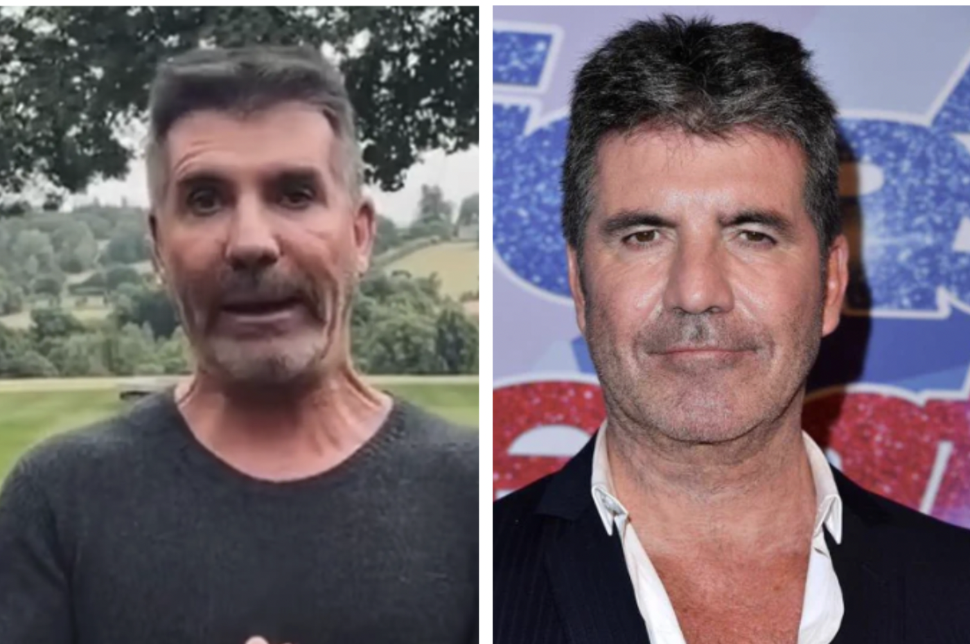 Simon Cowell Bought A New Face | OutKick