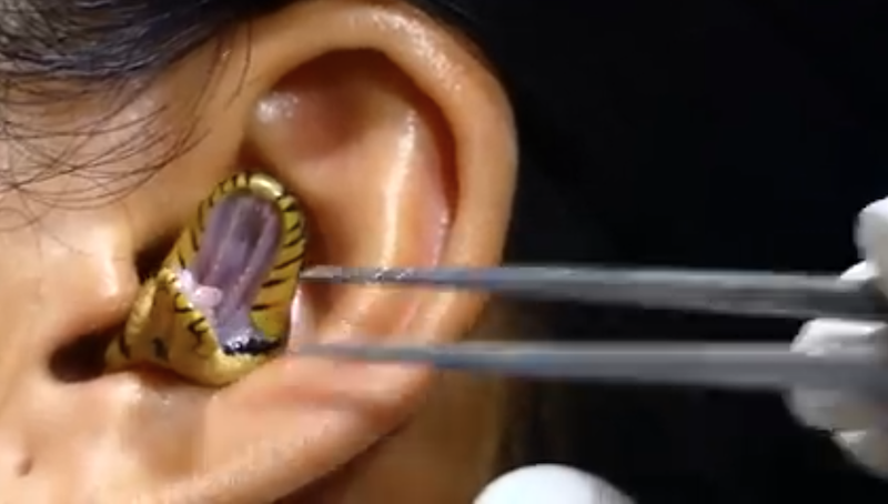 Snake Stuck In Woman's Ear Refuses To Come Out - Watch This! | OutKick