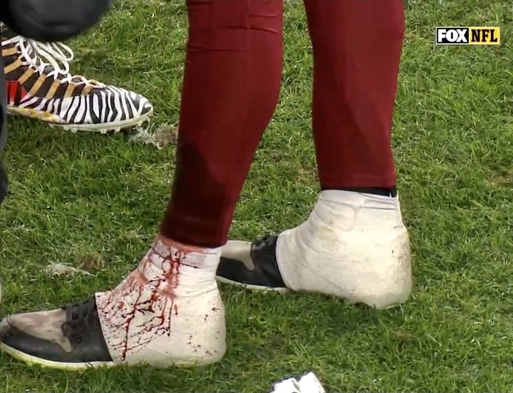 Alex Smith Gushing Blood from Leg | OutKick