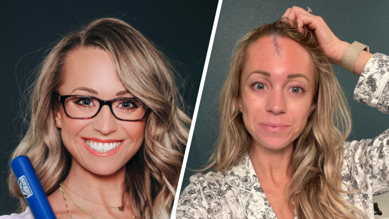 Rockies TV Reporter Kelsey Wingert Is Recovering Well After Being ... Rockies TV Reporter Kelsey Wingert Is Recovering Well After Being ...