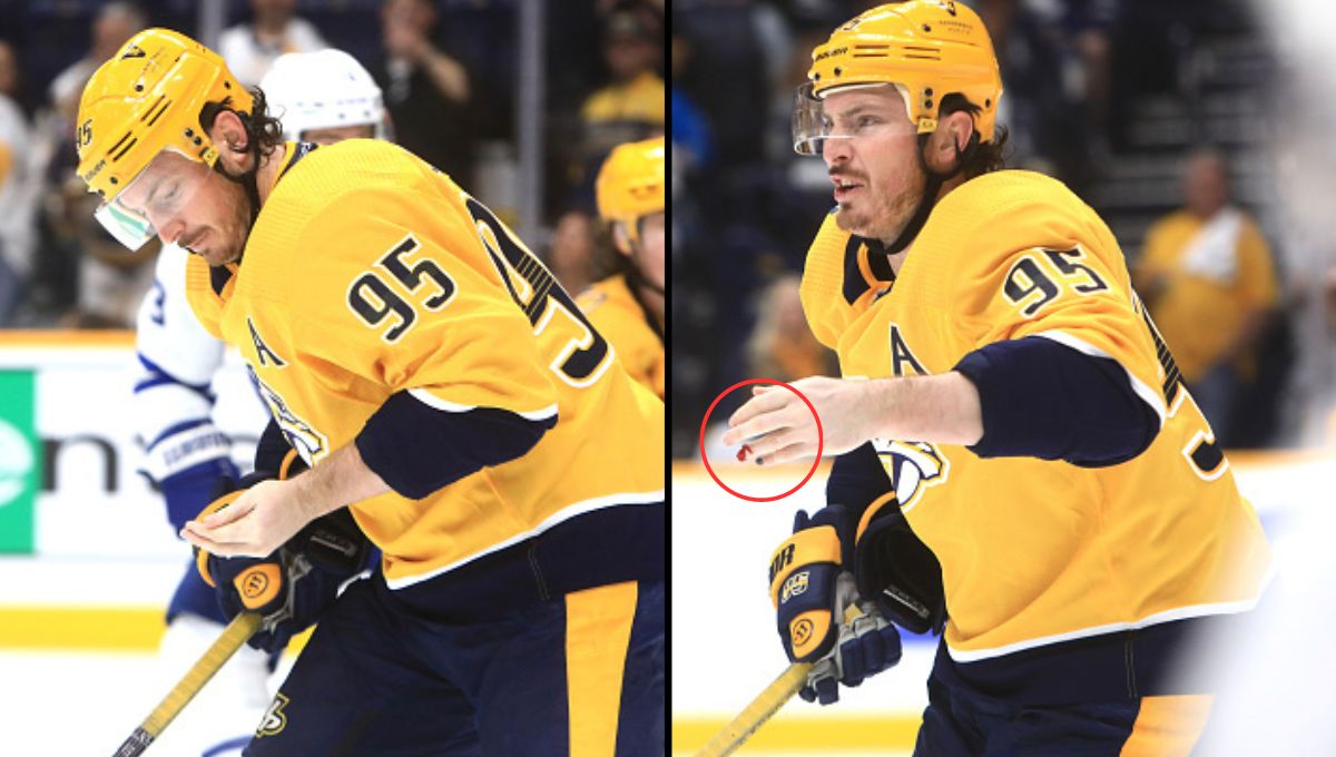 Nashville Predators Forward Matt Duchene Loses Piece of Finger After In ...