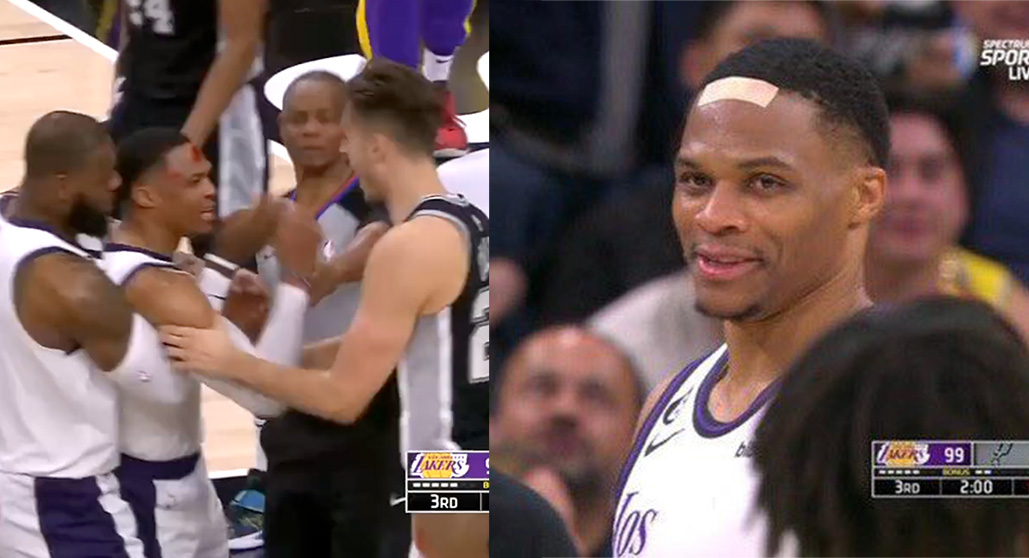 Russell Westbrook Tries To Fight Spurs After Hard Foul Gashes His Head | OutKick