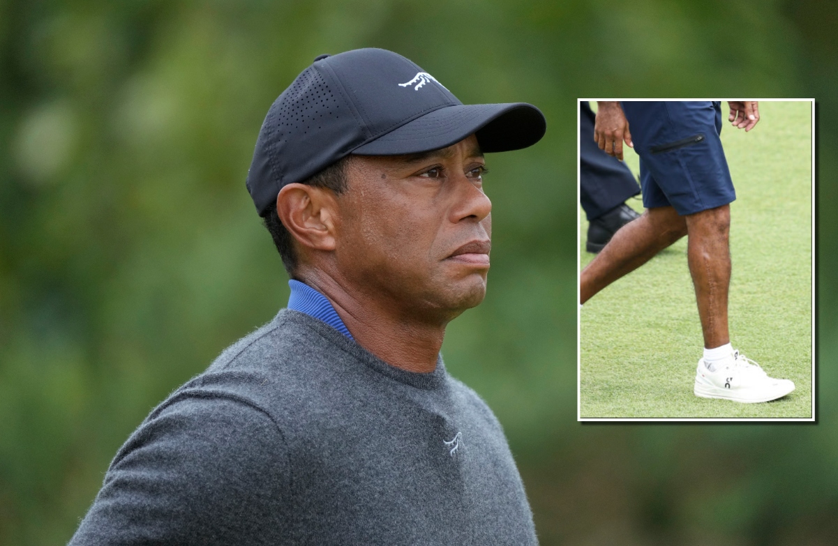 Tiger Woods Reveals Leg Scar For First Time Since 2021 Car Crash | OutKick